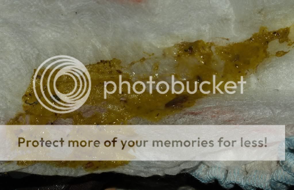 Poop pics, can anyone help? | BabyCenter